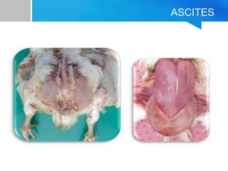 Ascites | PPT