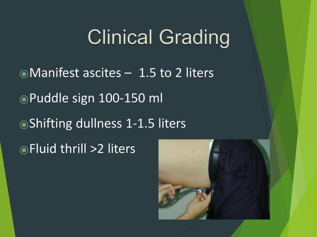 ASCITES MEdical Presentation in Surgery.pptx