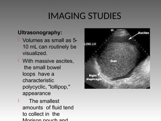 basics of ascites in children by dr rajeshri.pptx
