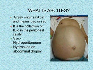 Ascites by dr. p.b.sadiq_ulla | PPT