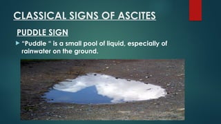 ASCITES IN CHILDREN. powerpointpresentation | PPTX