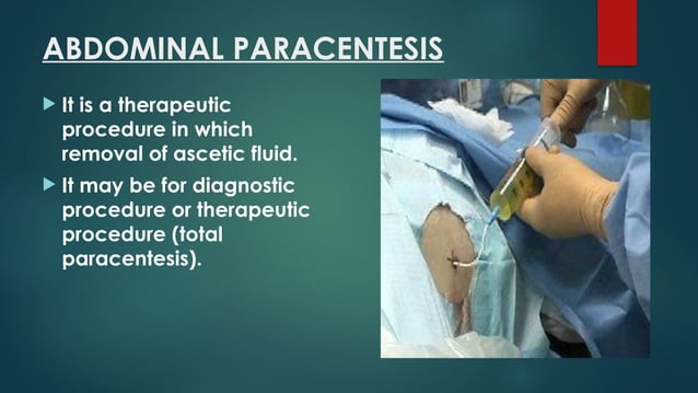 ASCITES IN CHILDREN. powerpointpresentation | PPTX | Digestive ...