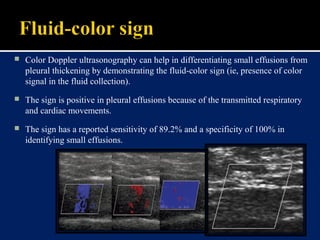 Ascites and Pleural Effusion | PPT