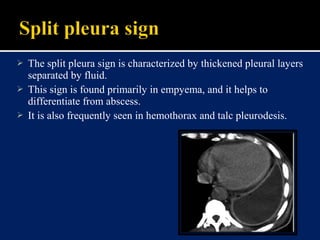 Ascites and Pleural Effusion | PPT