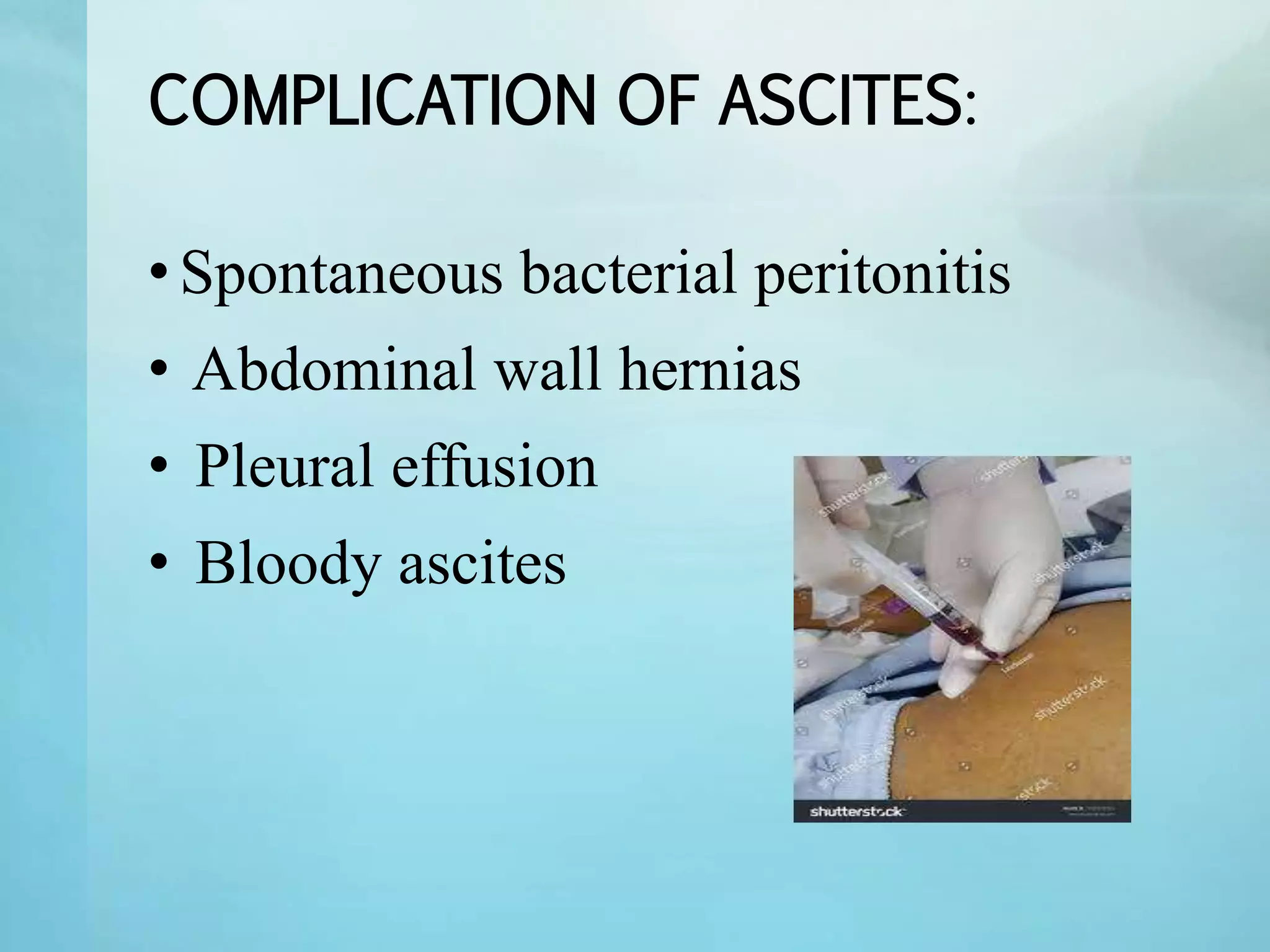 Ascites ppts | PPTX