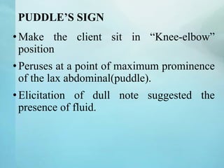 Ascites ppts | PPTX