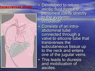 Peritoneovenous Shunt