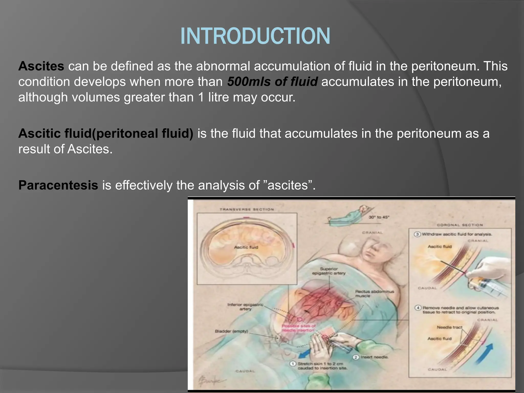 ASCITIC FLUID- Definition and Assesment.pptx