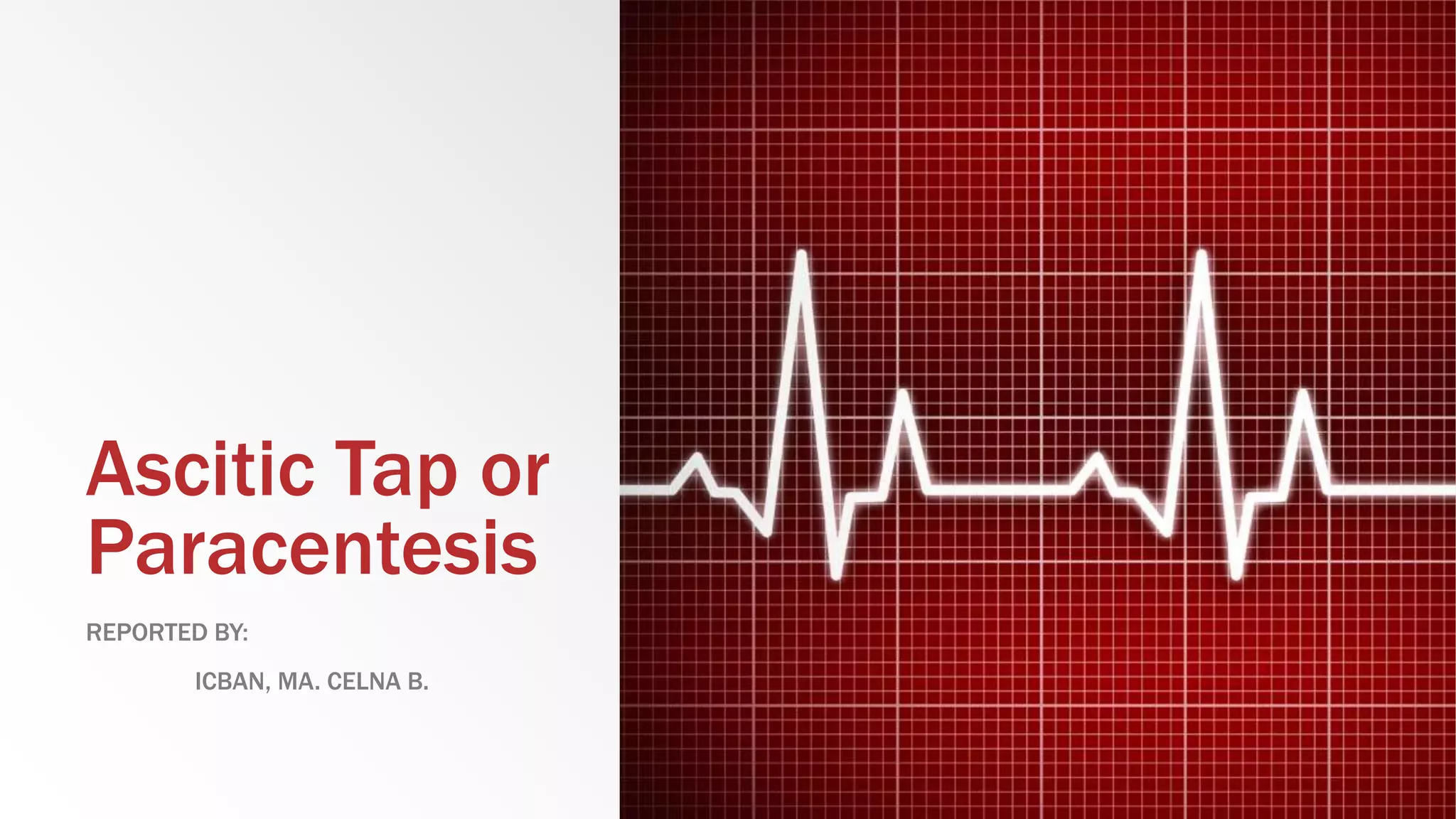 Ascitic tap or paracentesis | PPTX