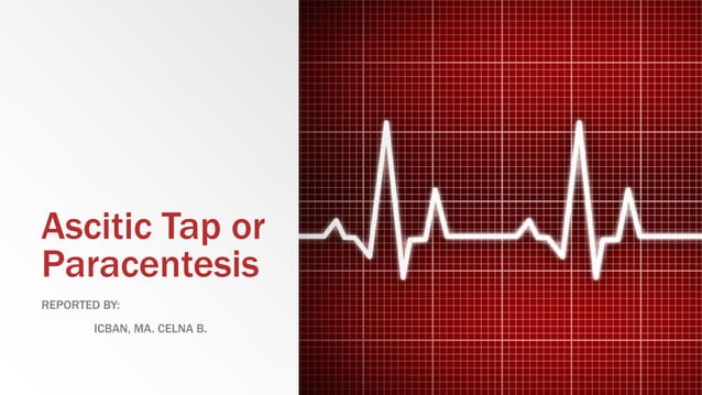Ascitic tap or paracentesis | PPTX | First Aid | Injuries