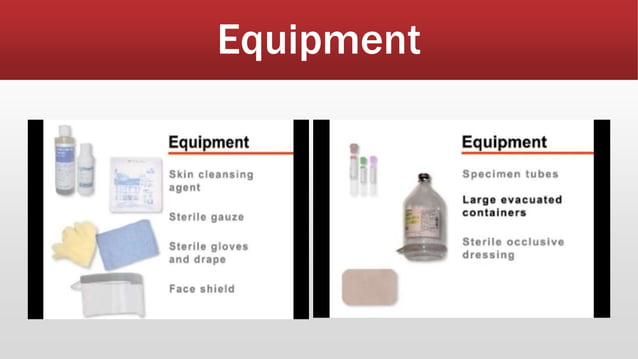 Ascitic tap or paracentesis | PPTX | First Aid | Injuries