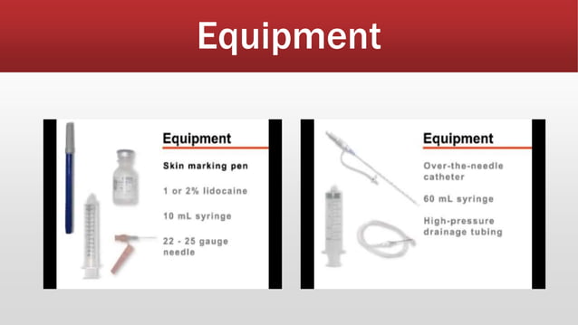 Ascitic tap or paracentesis | PPTX | First Aid | Injuries
