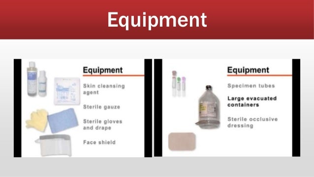 Ascitic tap or paracentesis