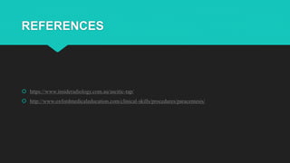 Ascitic tap procedure | PPTX