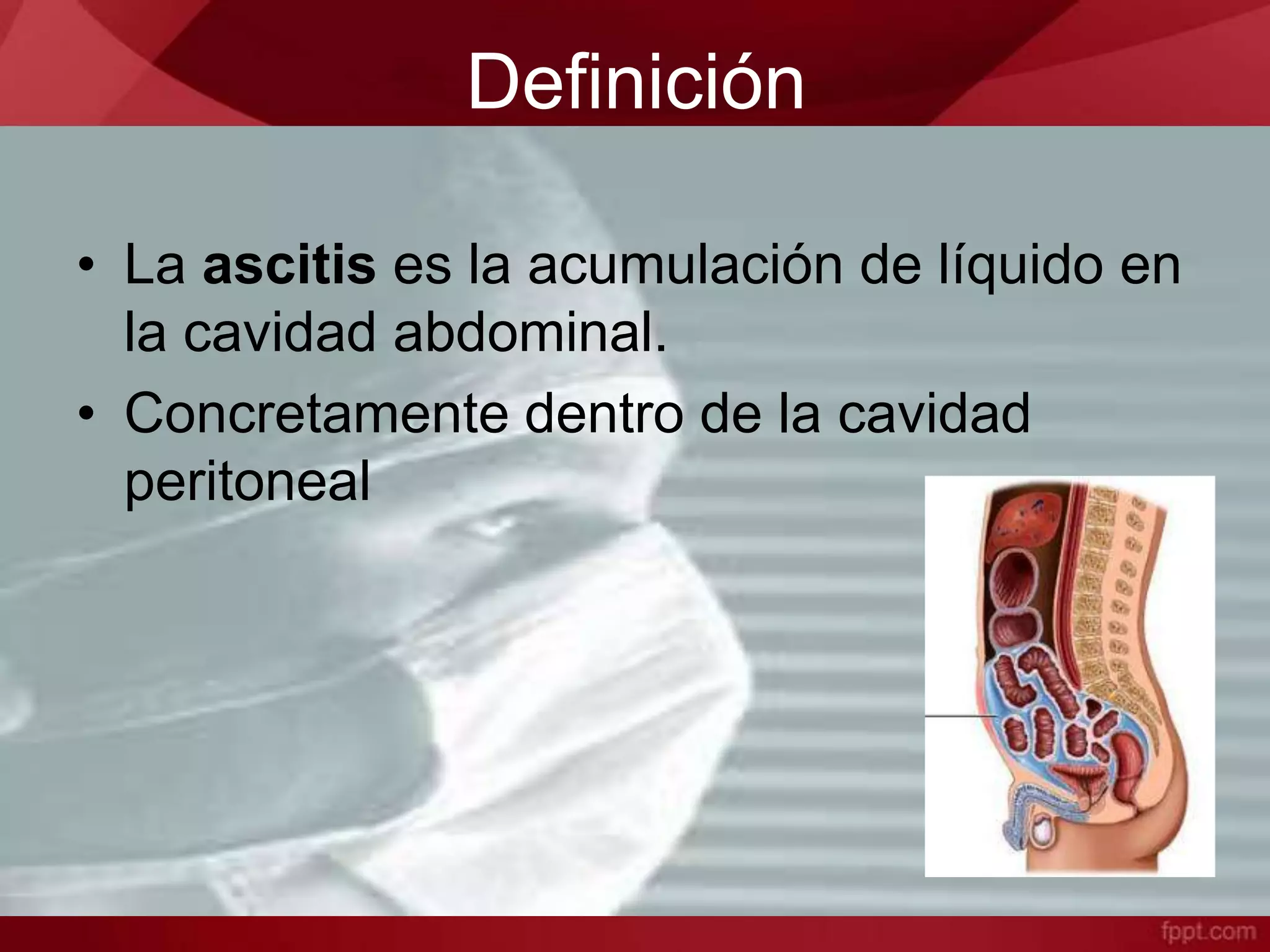 Ascitis | PPT