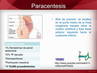 Ascitis | PPTX
