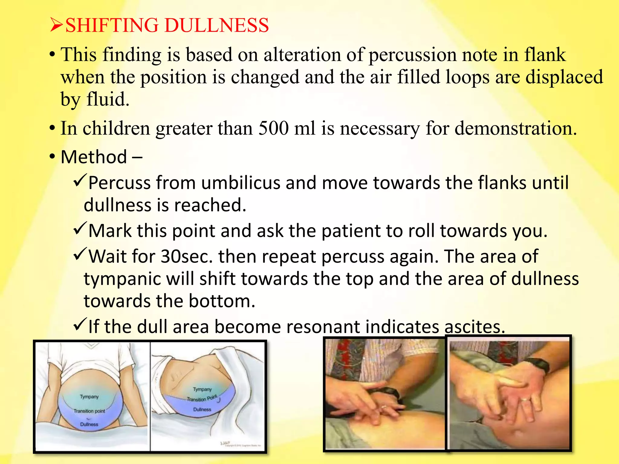 ASCITIS IN CHILDREN BY DR VIJITHA | PPTX