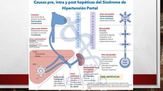 ASCITIS, TIPOS DE LIQUIDO ASCITICO, FISIOPATOLOGIA Y ABORDAJE ...