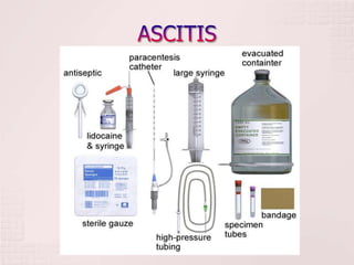 Ascitis | PPTX