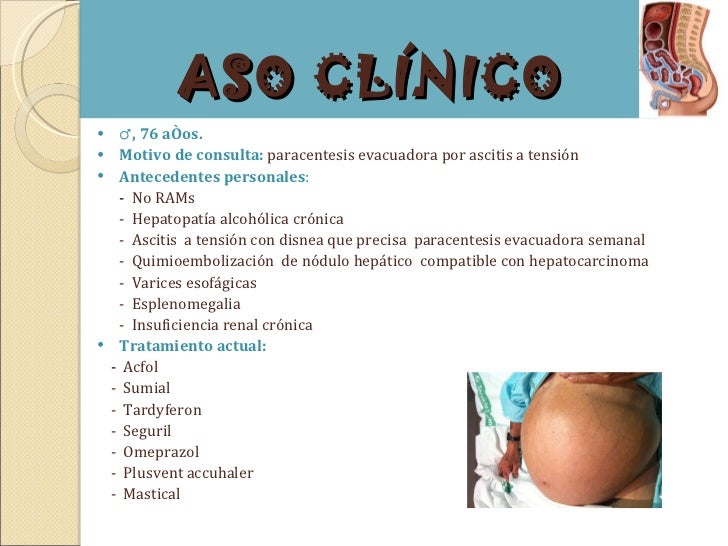 Ascitis[muñoz, lópez]