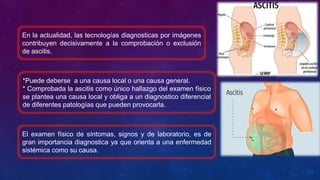 Ascitis | PPTX