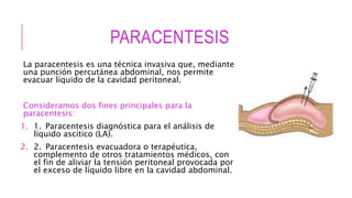 Ascitis e hipertensión abdominal | PPTX