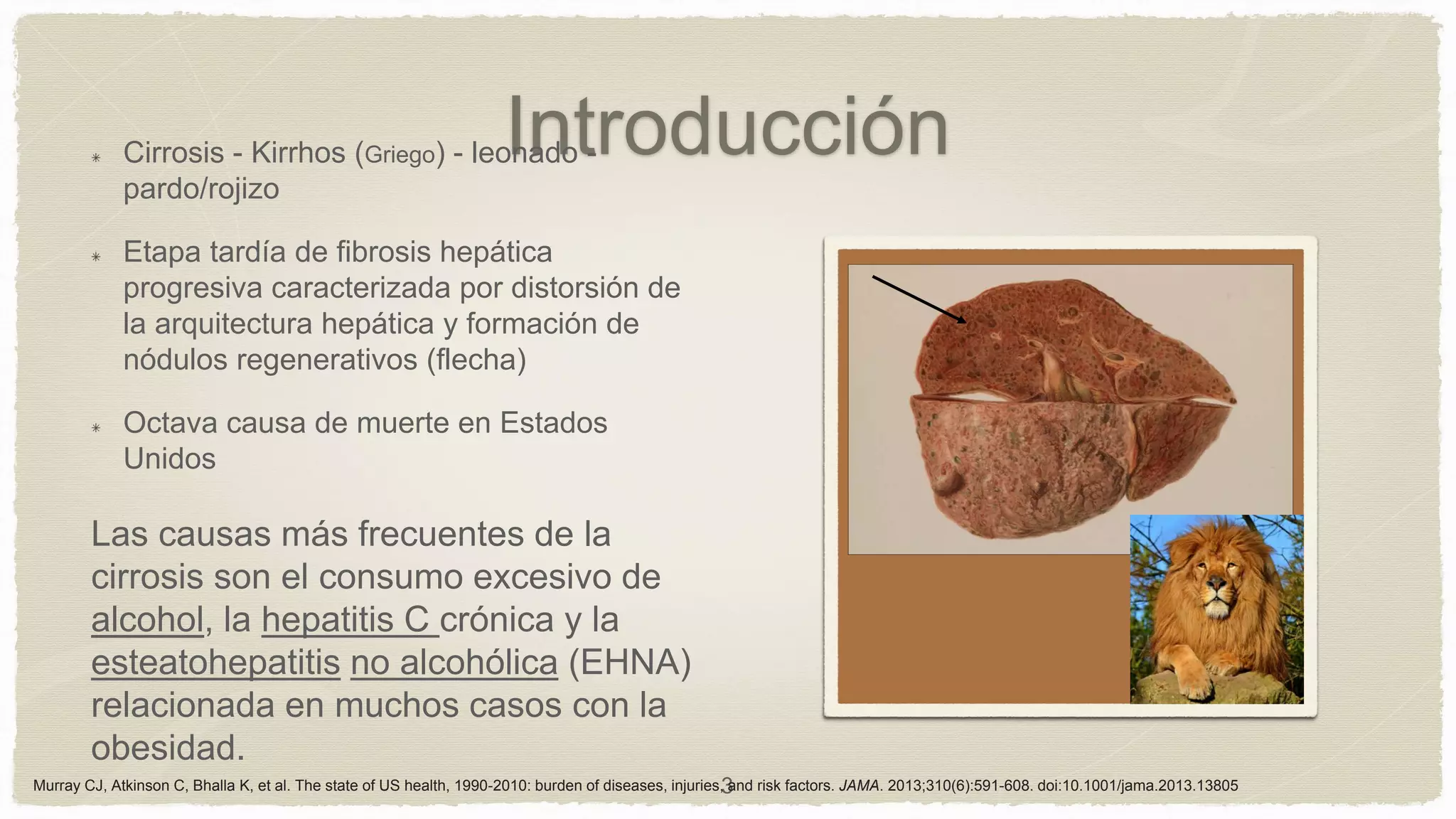 Ascitis y pbe en cirrosis hepática | PPTX