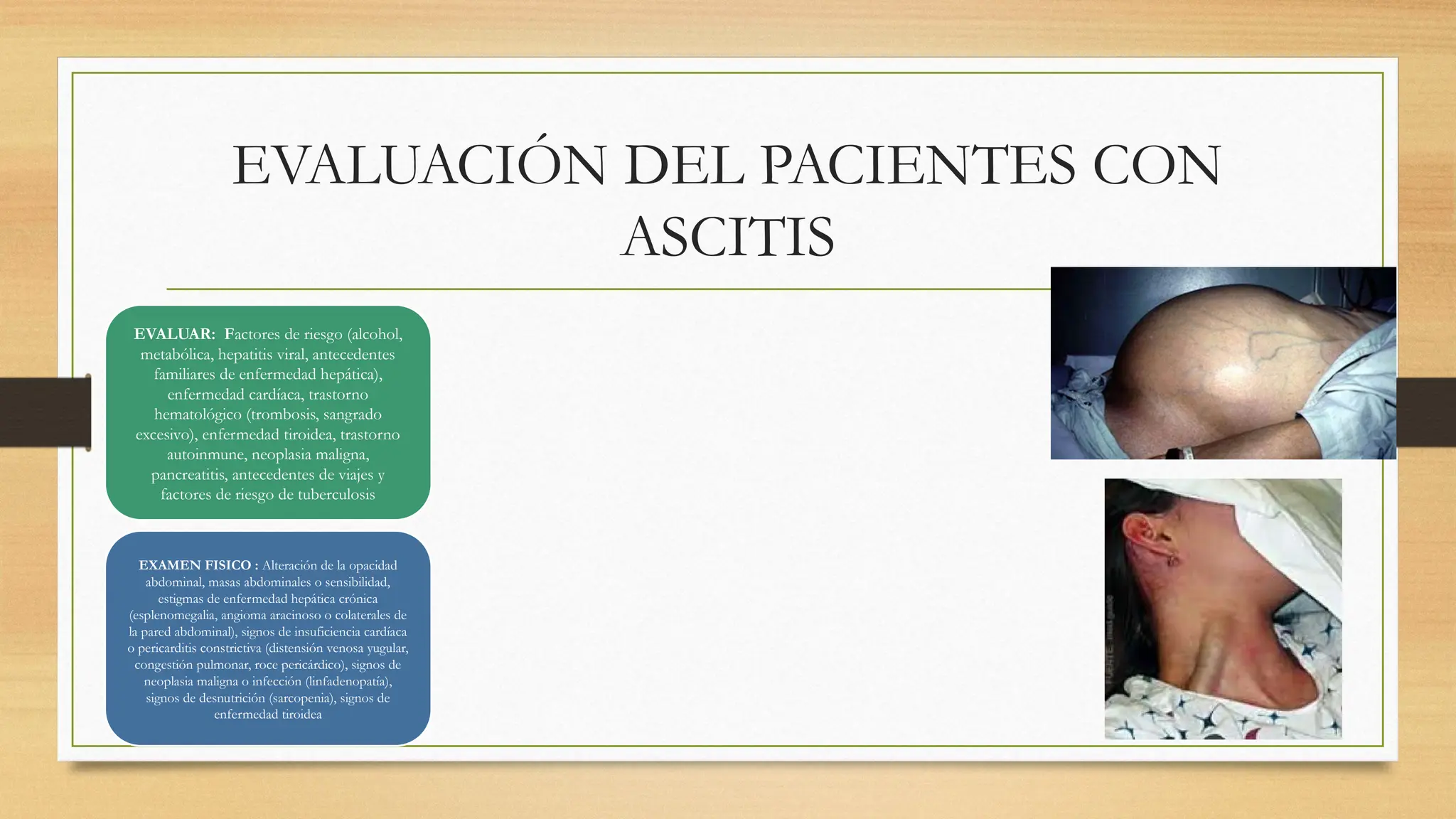 ascitis y PBE complicaciones de la cirrosis hepática | PPT