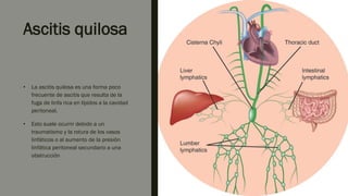 Ascitis y Peritonitis primaria Medicina. | PDF