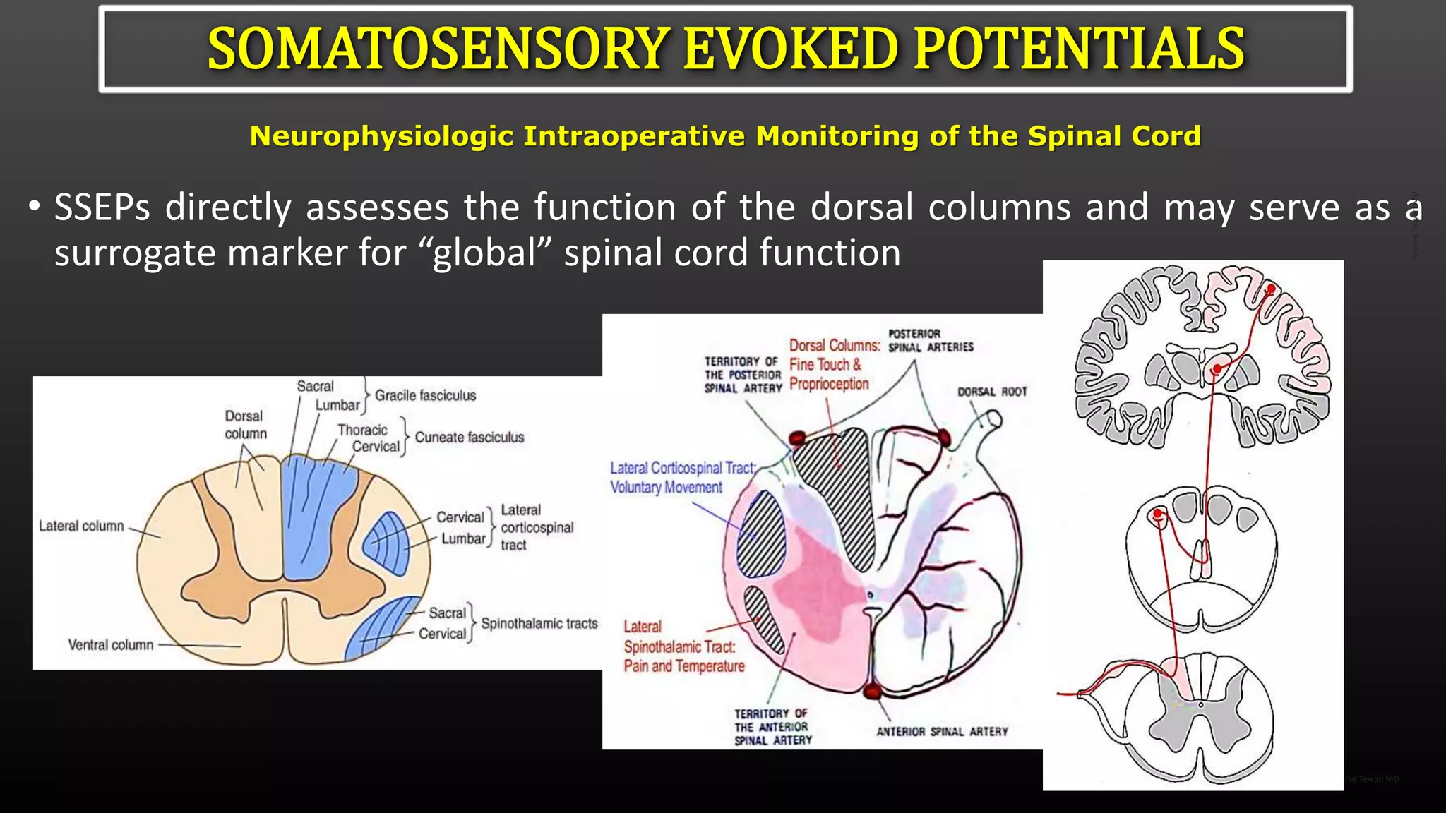 Guideline 11B: RECOMMENDED STANDARDS FOR INTRAOPERATIVE MONITORING OF ...