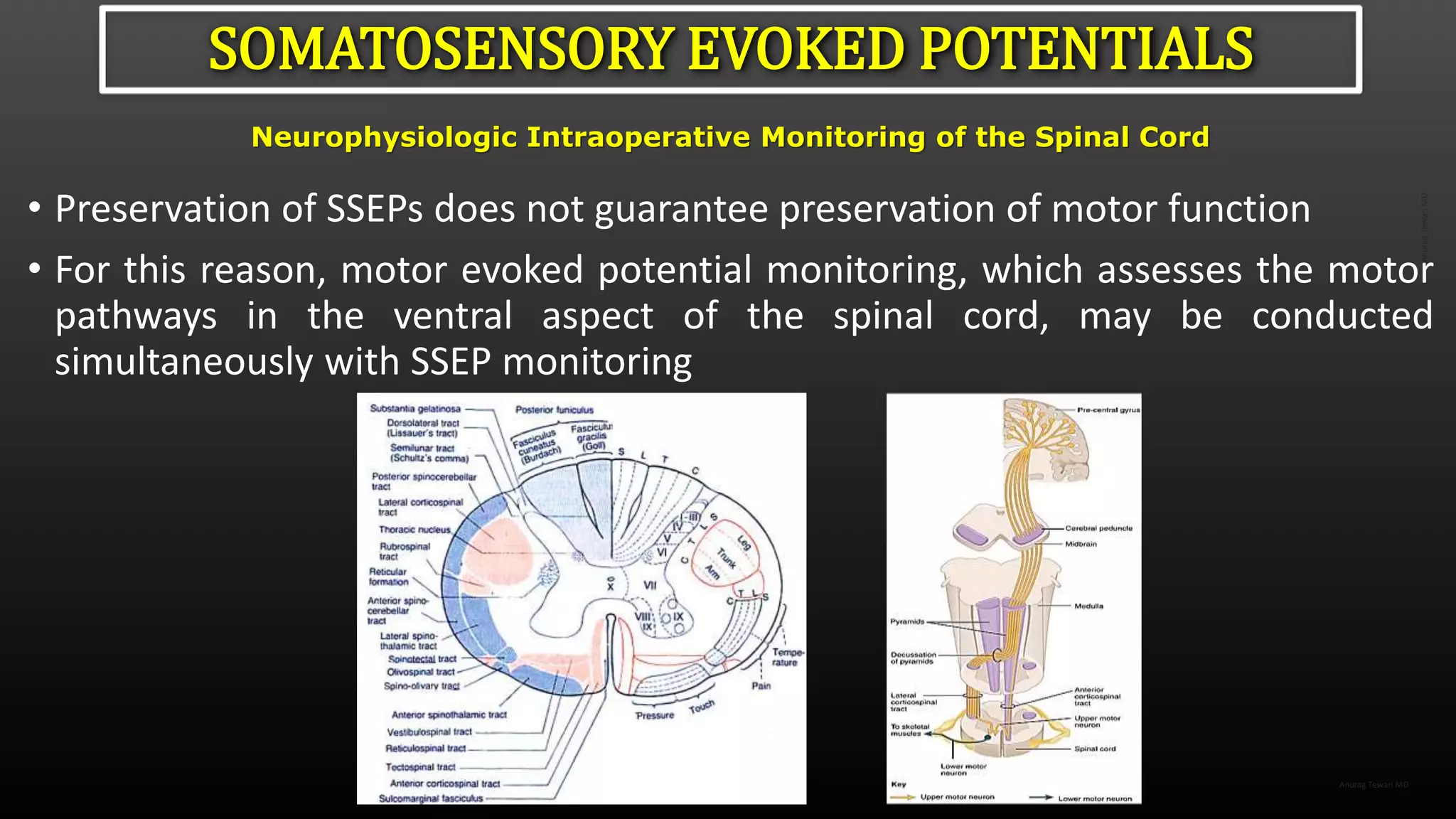 Guideline 11B: RECOMMENDED STANDARDS FOR INTRAOPERATIVE MONITORING OF ...