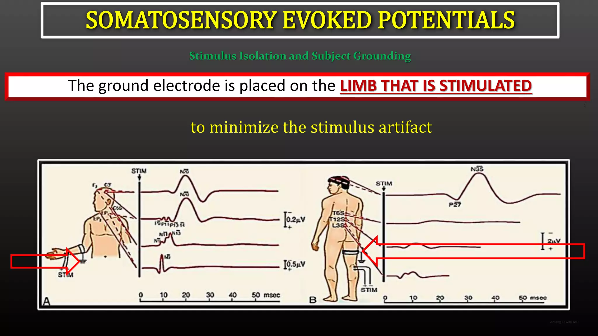 Guideline 11B: RECOMMENDED STANDARDS FOR INTRAOPERATIVE MONITORING OF ...