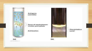 Ascoli test(Ascoli ring test) | PPT