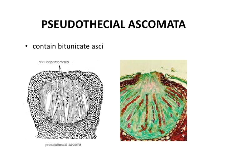 Ascomycota