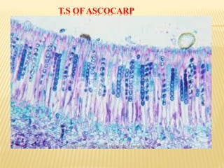 Ascomycotina - Ecology and Life Cycle | PDF