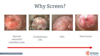 ASCO 2019 presentation by Dr. Ian McGowan | PDF