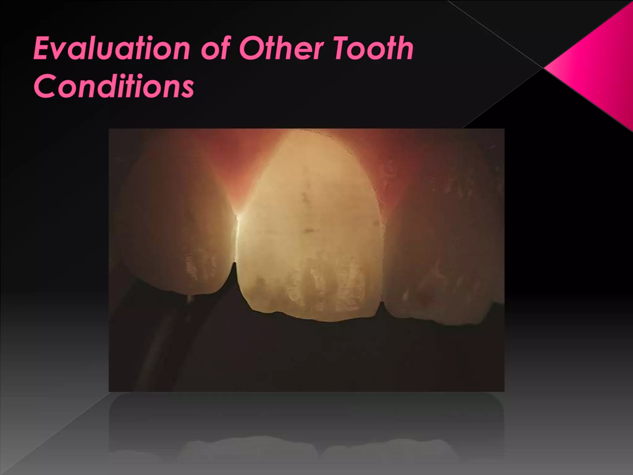 Fiber-OpticTransillumination In dentistry | PPTX