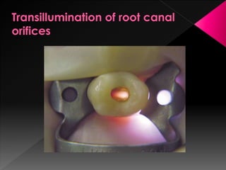 Fiber-OpticTransillumination In dentistry | PPTX