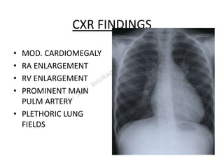 ATRIAL SEPTAL DEFECT (ASD) | PPT
