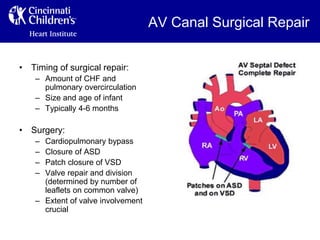 definitionofatrialseptaldefectlecturer.ppt