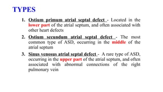 Atrial septal defect in children .pptx