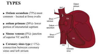 ASD.pptx for nursing students congenital heart defect | PPT
