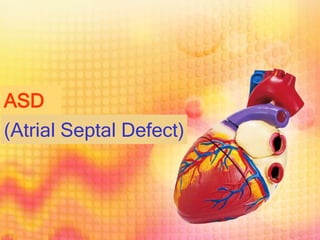 ASD- ASO | PPTX