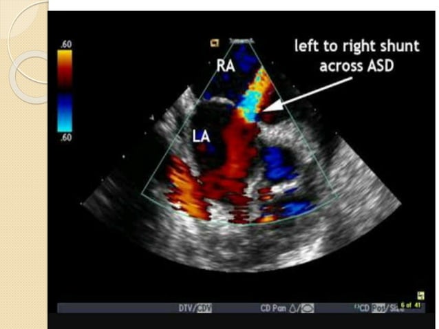 Asd investigations and management | PPTX