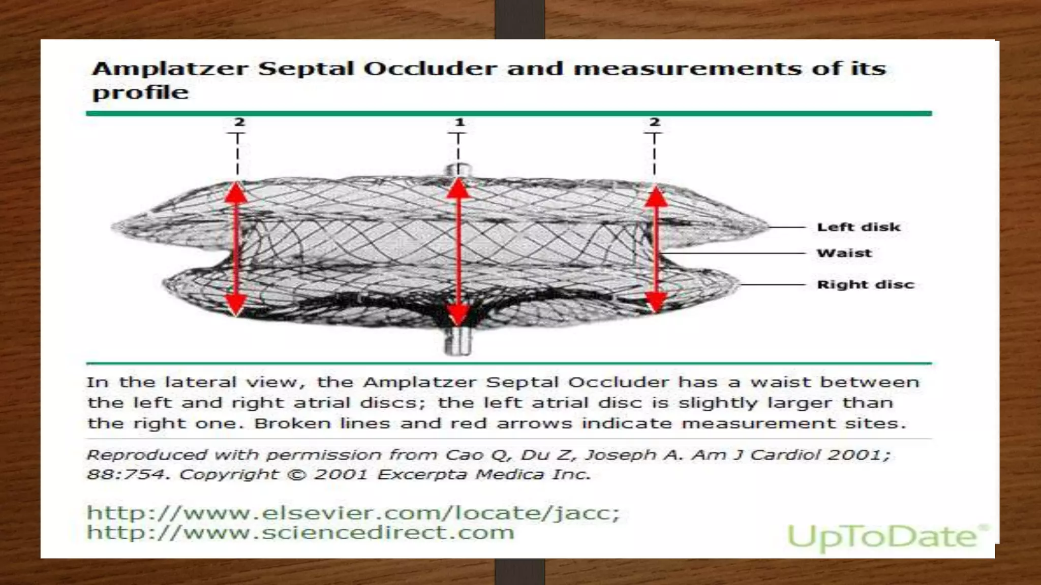 Asd device closure | PPTX