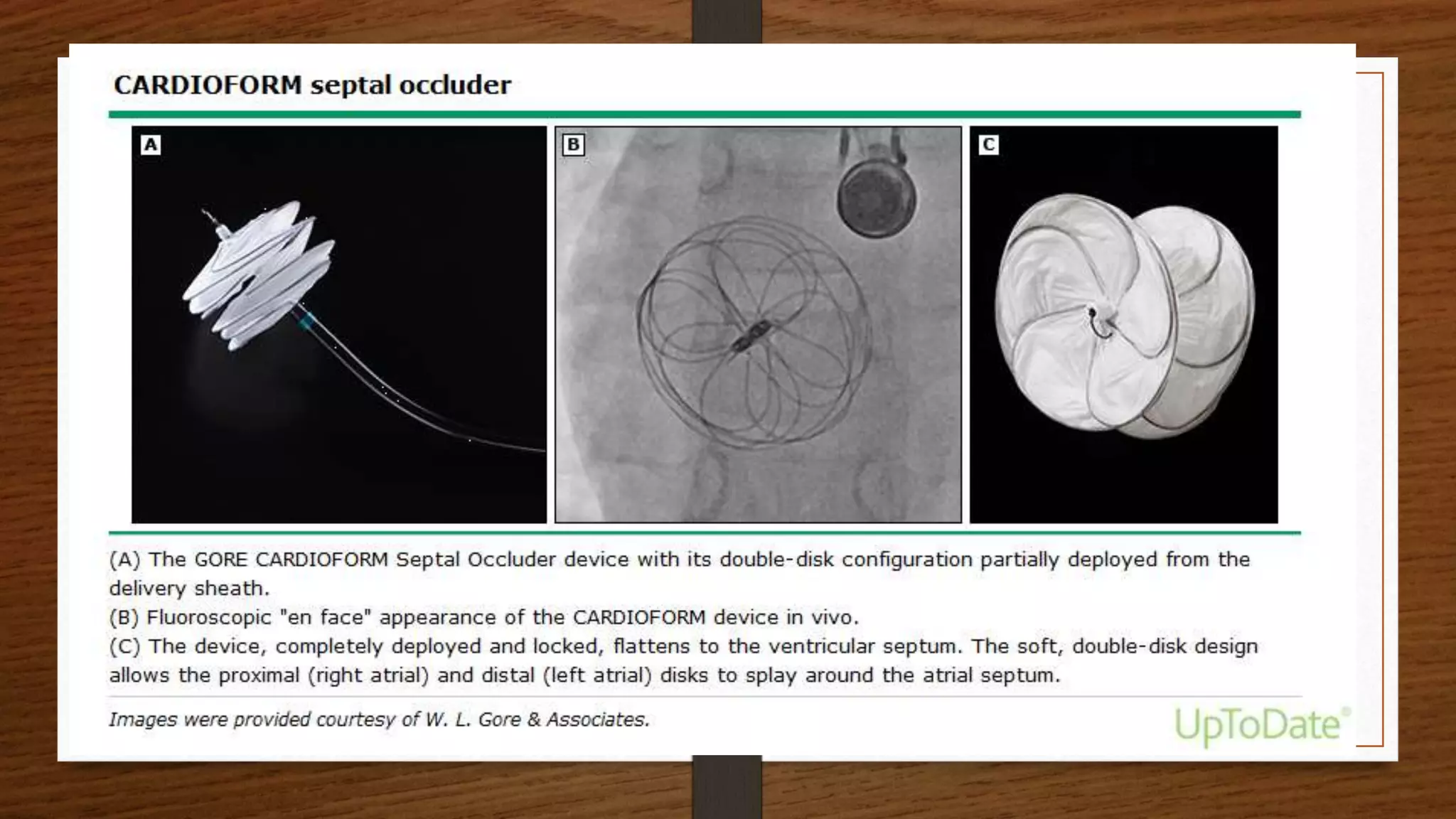 Asd device closure | PPTX