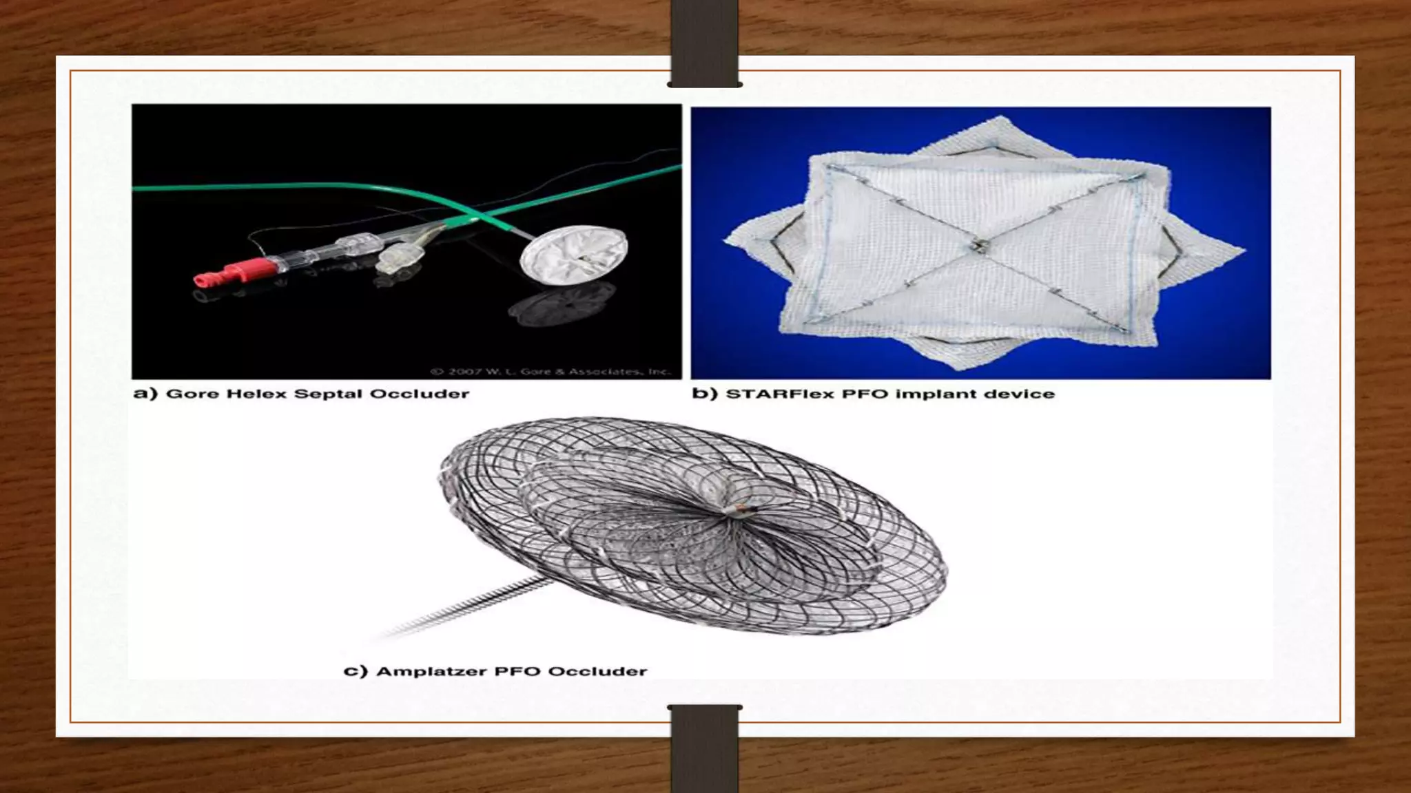 Asd device closure | PPTX
