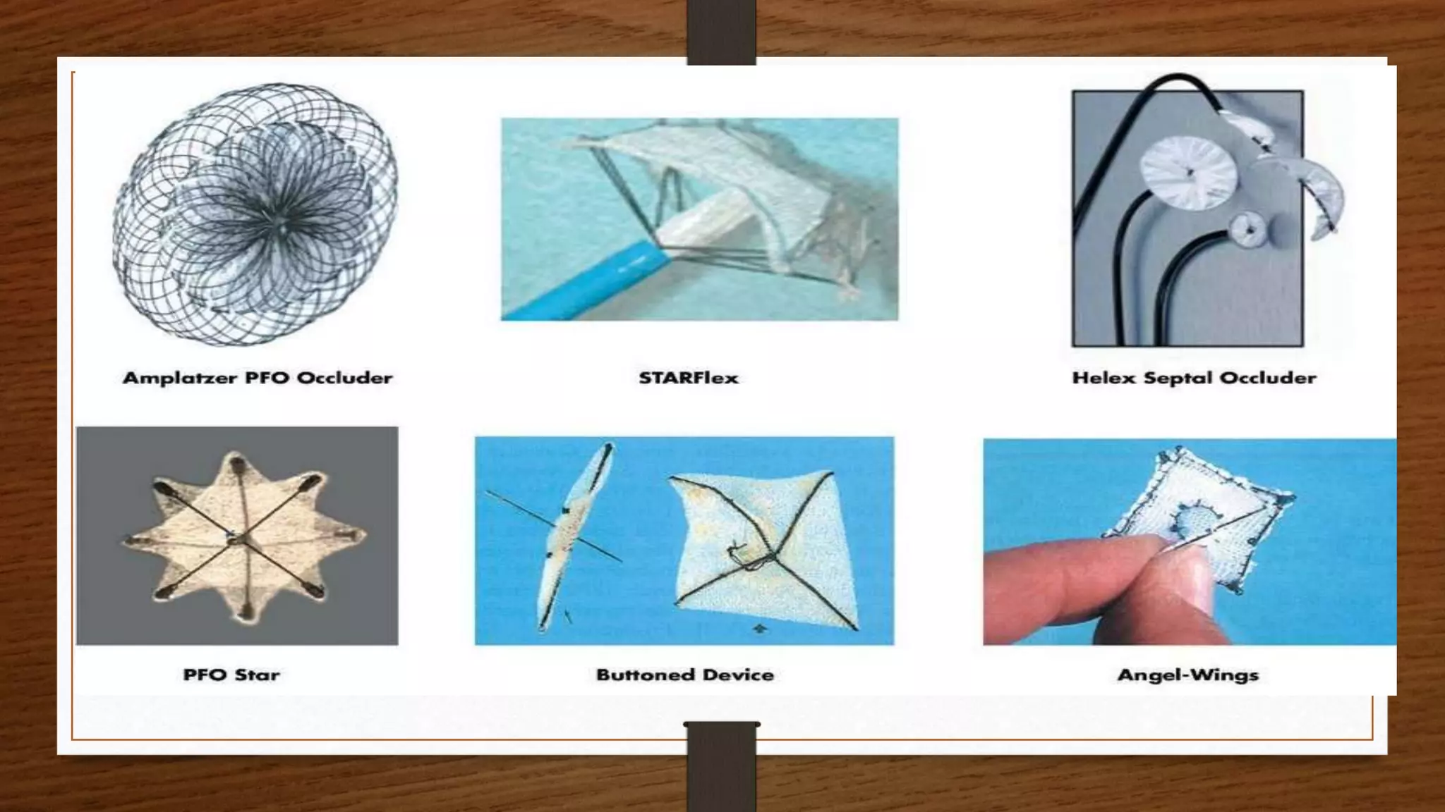 Asd device closure | PPTX