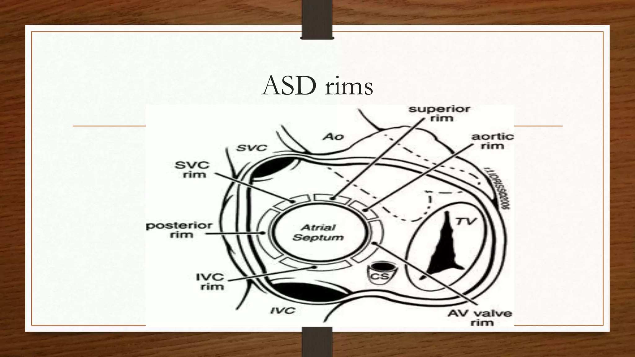 Asd device closure | PPTX