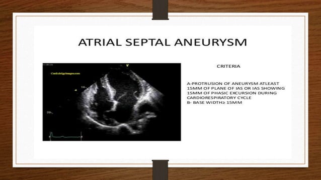 Asd device closure | PPTX